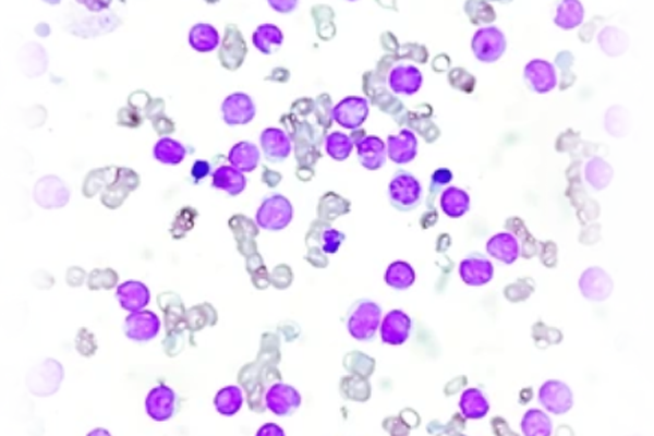 Hematology Cancer Panel – GC Genome